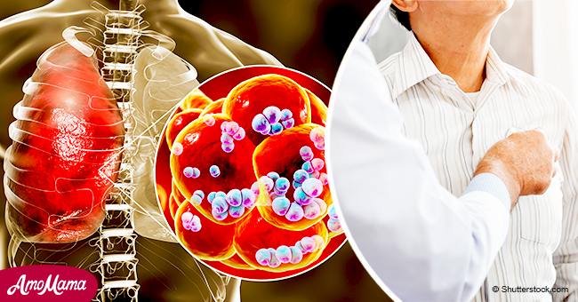 Neumococo: todo lo que necesitas saber sobre la bacteria que causa la ...