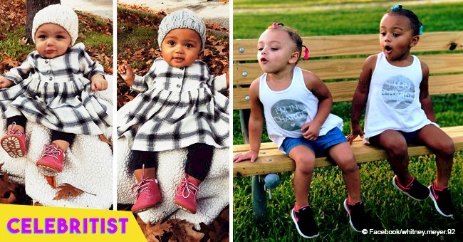 World famous twins born with different skin colors are now 21