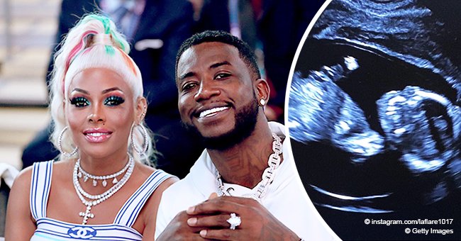 See the Sonogram Gucci Mane Shared as He & Wife Keyshia Ka'oir Are ...