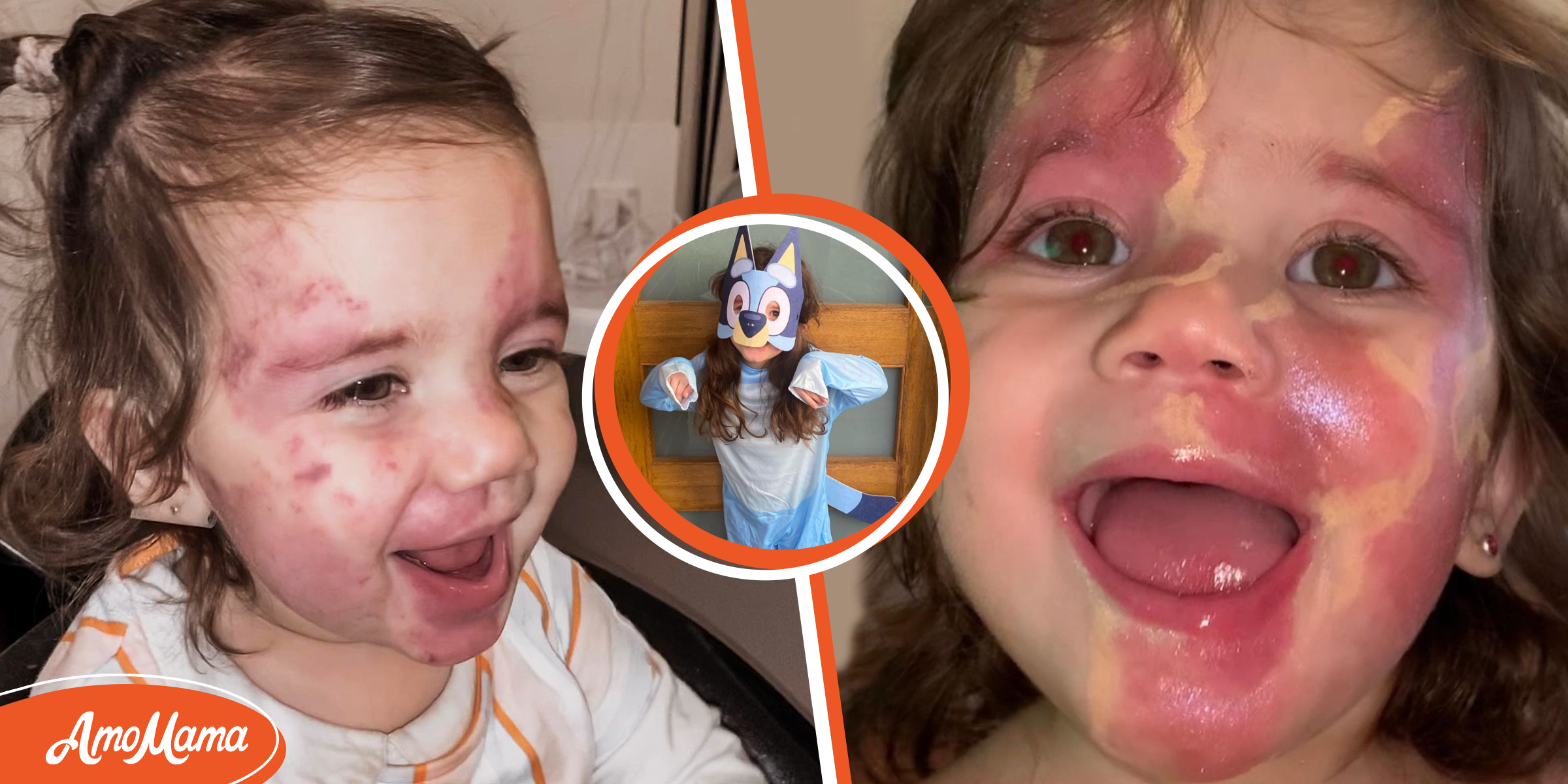 "Ihr Gesicht sah gegrillt aus": Das als "hässlich" bezeichnete Baby ist ...