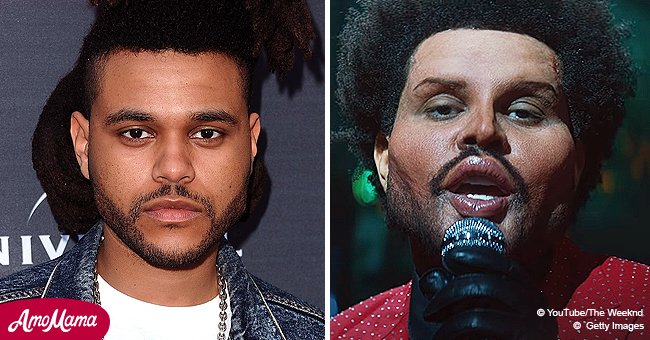 The Weeknd Looks Barely Recognizable with Face Fillers in His 'Save ...
