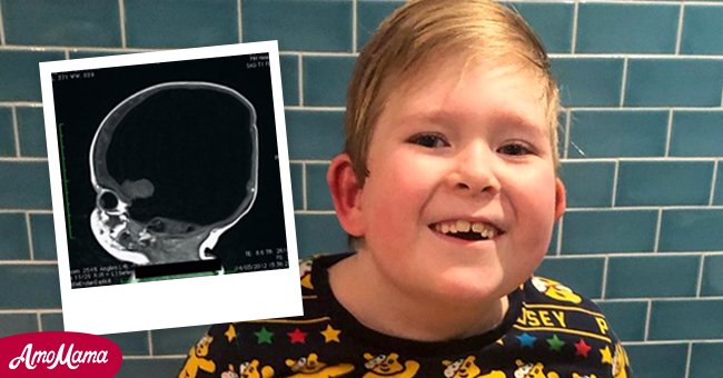 Noah Wall Was Born with Just 2% Of his Brain and May Be Paralized but ...