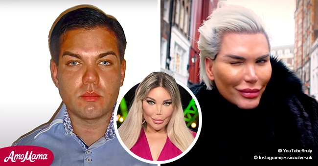 Rodrigo Alves Was The Human Ken Doll And Came Out As Transgender