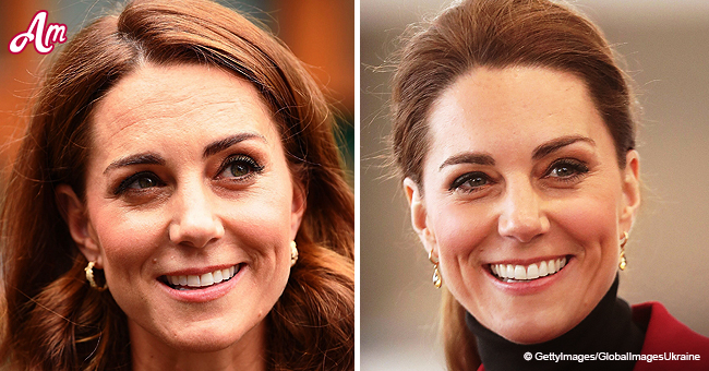 Kate Middleton a fait des injections de Botox, selon l’affiramtion d’un ...