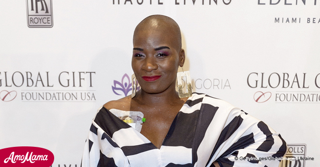 'The Voice' Contestant Janice Freeman's Cause of Death Revealed