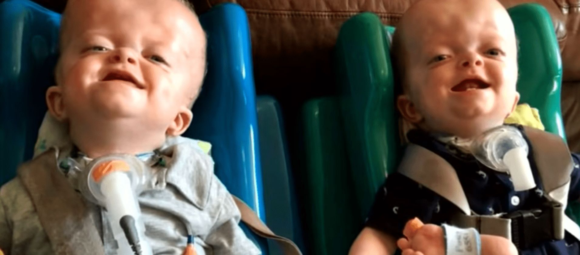 Nurse Adopts Twins with Rare Disability after Parents Couldn't Care For ...