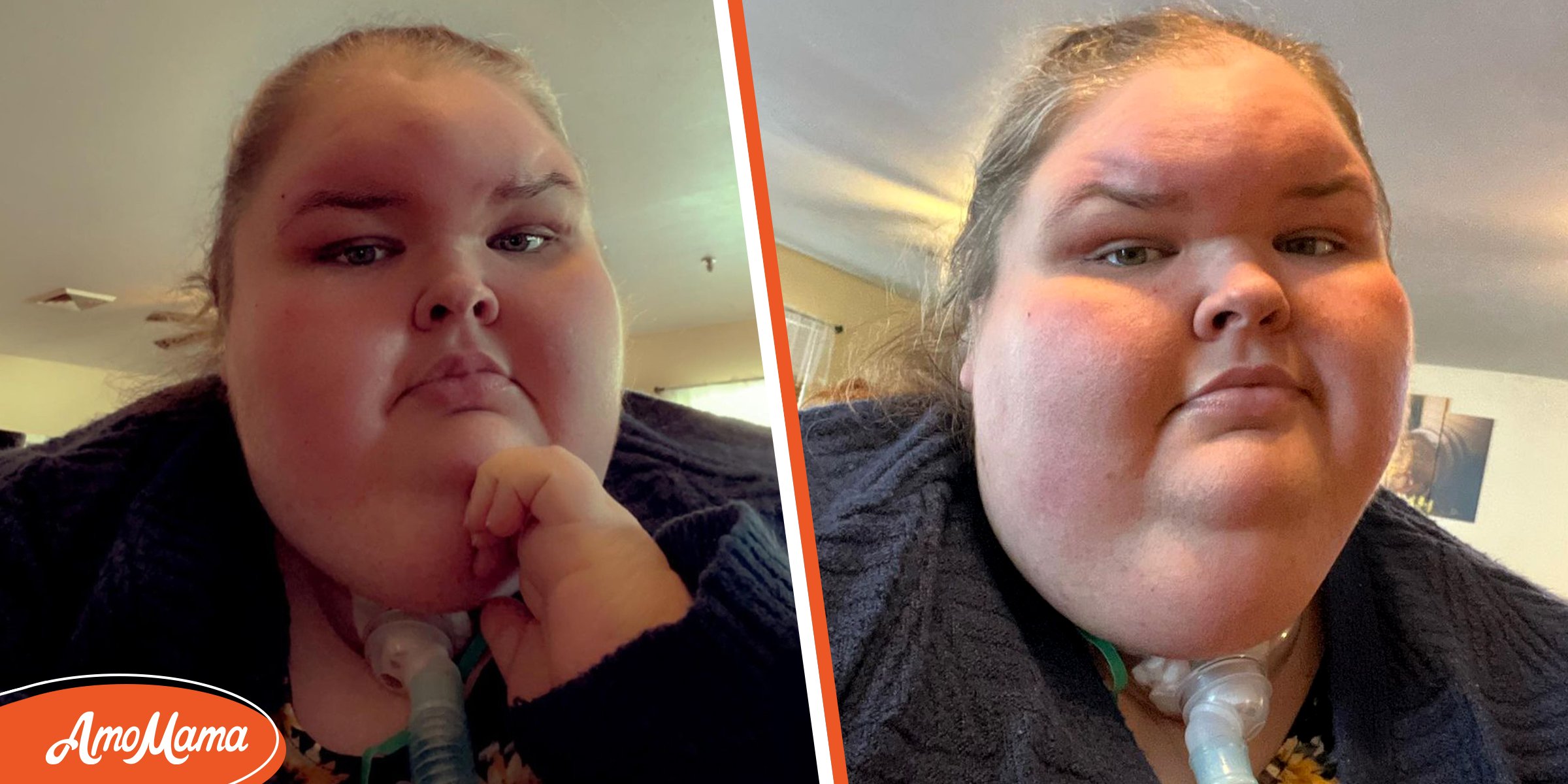 Why Is Tammy Slaton's Forehead Attracting Attention? '1000-Lb Sisters ...