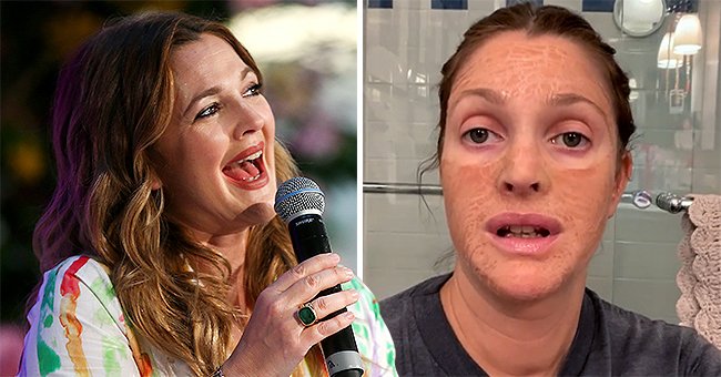 Drew Barrymore Looks Unrecognizable as She Can Barely Move Her Lips ...
