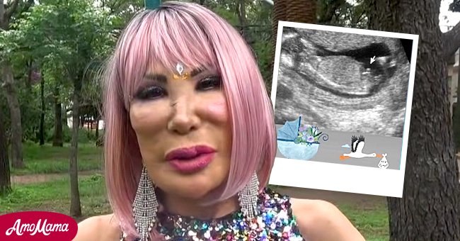 ¡Será niño! Lyn May comparte ultrasonido tras anunciar su supuesto embarazo