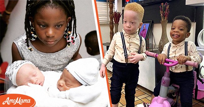 Black Parents Give Birth to Identical Set of Twins with Different Skin ...
